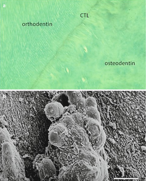 Pulp Aging: Fibrosis and Calcospherites | SpringerLink