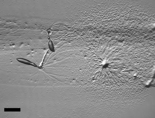 2 Excavata: Acrasiomycota; Amoebozoa: Dictyosteliomycota, Myxomycota ...