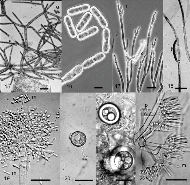 8 Zygomycetous Fungi: Phylum Entomophthoromycota and Subphyla ...