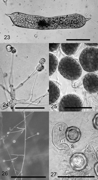 8 Zygomycetous Fungi: Phylum Entomophthoromycota and Subphyla ...