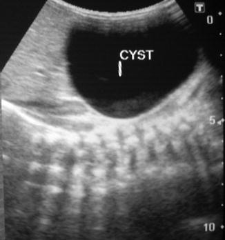Hymen | SpringerLink