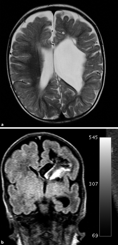 The Brain | SpringerLink