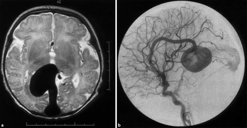 The Brain | SpringerLink