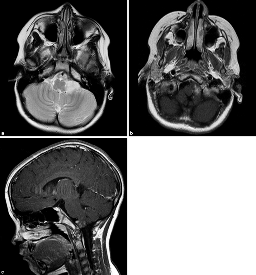 The Brain | SpringerLink