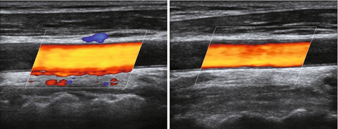 Ultrasound Imaging | SpringerLink