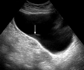 Ultrasound Imaging | SpringerLink