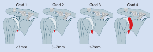 Obere Extremität | SpringerLink