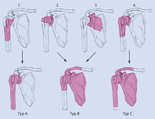 Obere Extremität | SpringerLink