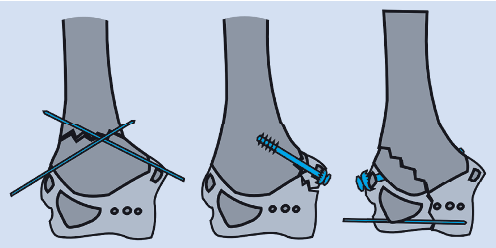 Obere Extremität | SpringerLink