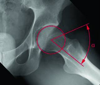 Untere Extremität | SpringerLink