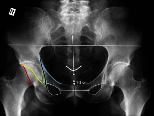 Untere Extremität | SpringerLink