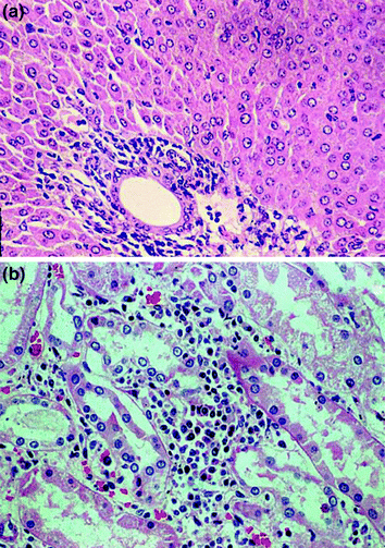 Leptospirosis in Humans | SpringerLink