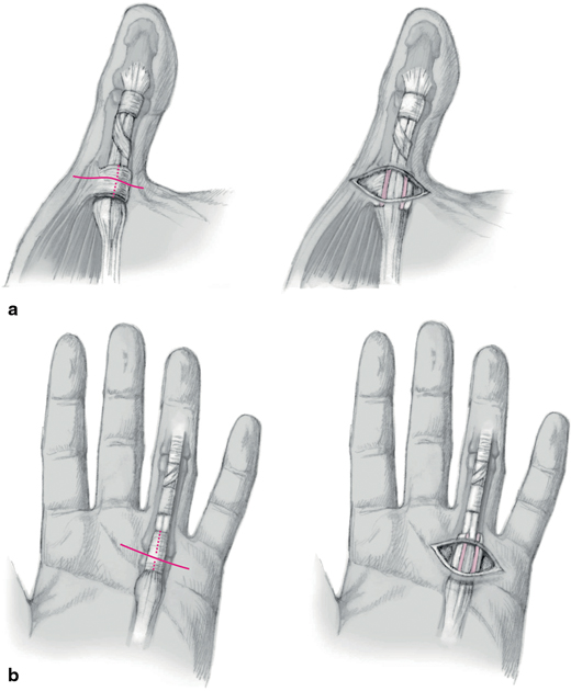 Therapie | SpringerLink