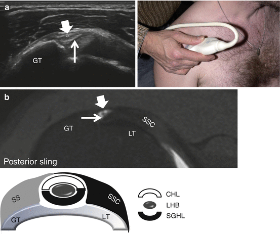 Shoulder Imaging | SpringerLink