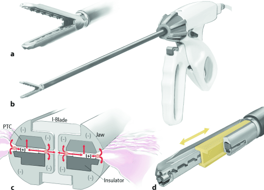Surgical Energy Devices or Devices for Hemostasis | SpringerLink