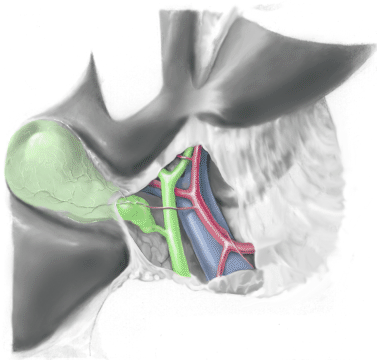 Choledochojejunostomy and Cholecystojejunostomy | SpringerLink