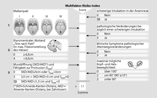 Atemwegsmanagement | SpringerLink
