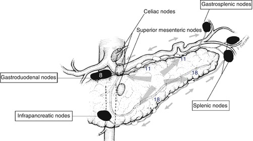 Radical Antegrade Modular Pancreato-splenectomy (RAMPS) | SpringerLink