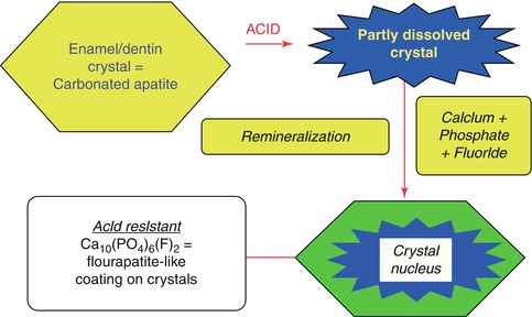 Demineralization and Remineralization | SpringerLink
