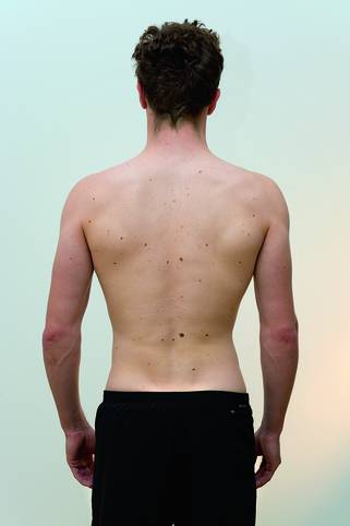 Wirbelsäule | SpringerLink