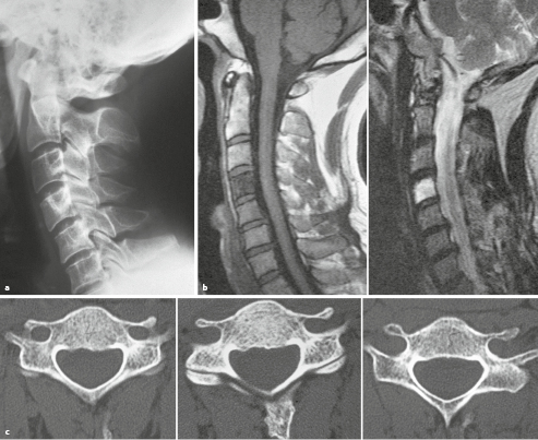 Perfusionsstörungen des Knochens und Knochenmarks | SpringerLink