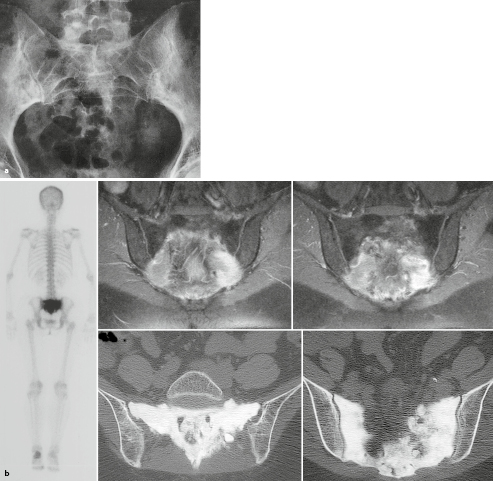 Perfusionsstörungen des Knochens und Knochenmarks | SpringerLink