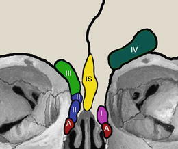 Surgical Anatomy and Embryology of the Frontal Sinus | SpringerLink