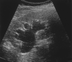 Abdomen | SpringerLink