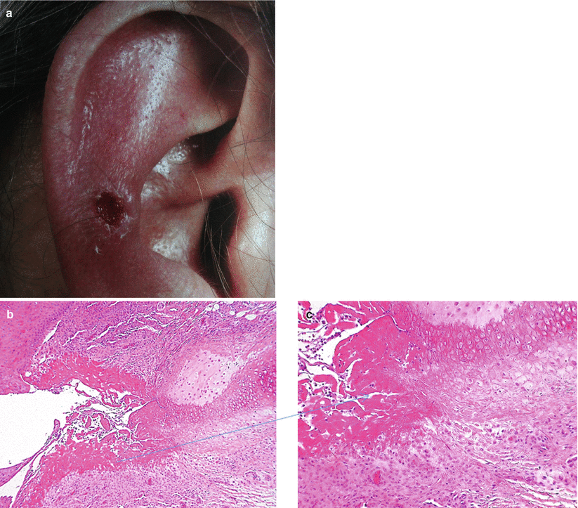 Ear and Temporal Bone | SpringerLink