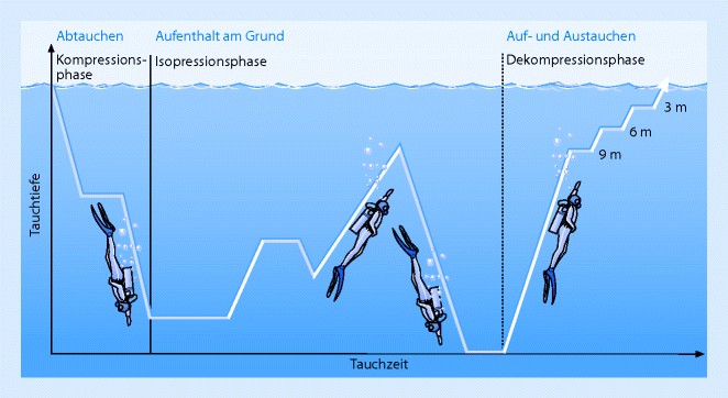 Dekompressionskrankheit (DCS = Decompression Sickness) | SpringerLink