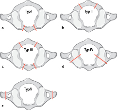 Bildgebung der Wirbelsäule | SpringerLink