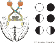 Sehnerv und Sehbahn | SpringerLink