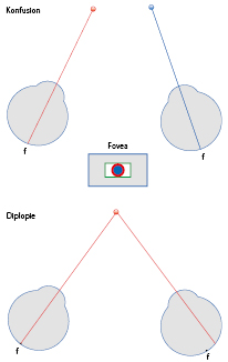 Strabismus | SpringerLink