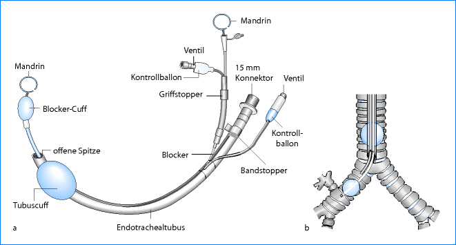 Lungenoperationen, Bronchoskopie, Tracheaoperationen | SpringerLink