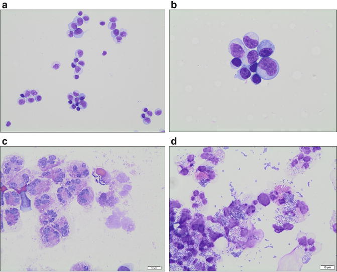 CSF and CNS Cytology | SpringerLink