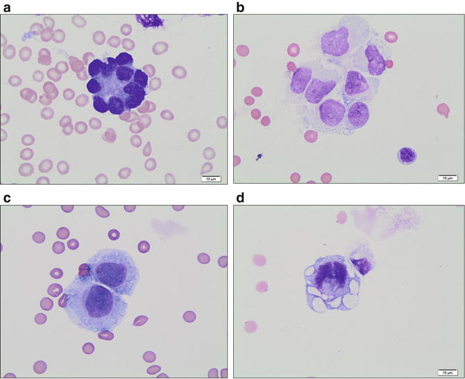 CSF and CNS Cytology | SpringerLink