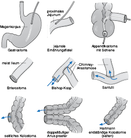 Magen-Darm-Erkrankungen | SpringerLink
