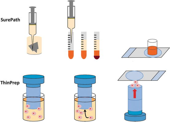 Liquid-Based Specimen Collection, Preparation, and Morphology ...