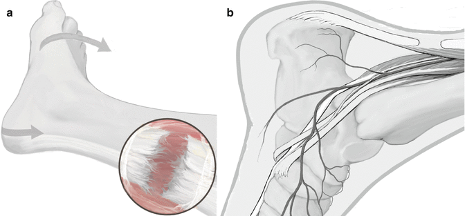 Gastrocnemius Slide | SpringerLink