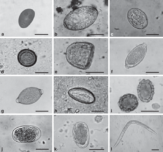 Parasitische Würmer (Helminthen) und Myxozoa | SpringerLink