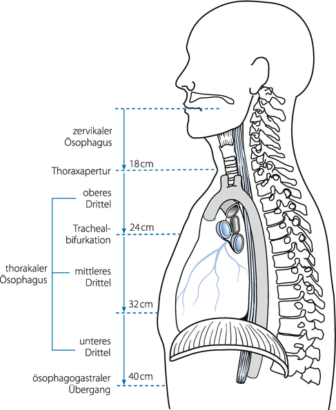 Ösophaguskarzinom | SpringerLink