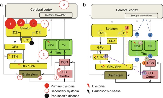Pathophysiology of Dystonia: Models and Mechanisms | SpringerLink