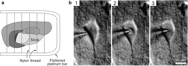 Slice Patch Clamp | SpringerLink