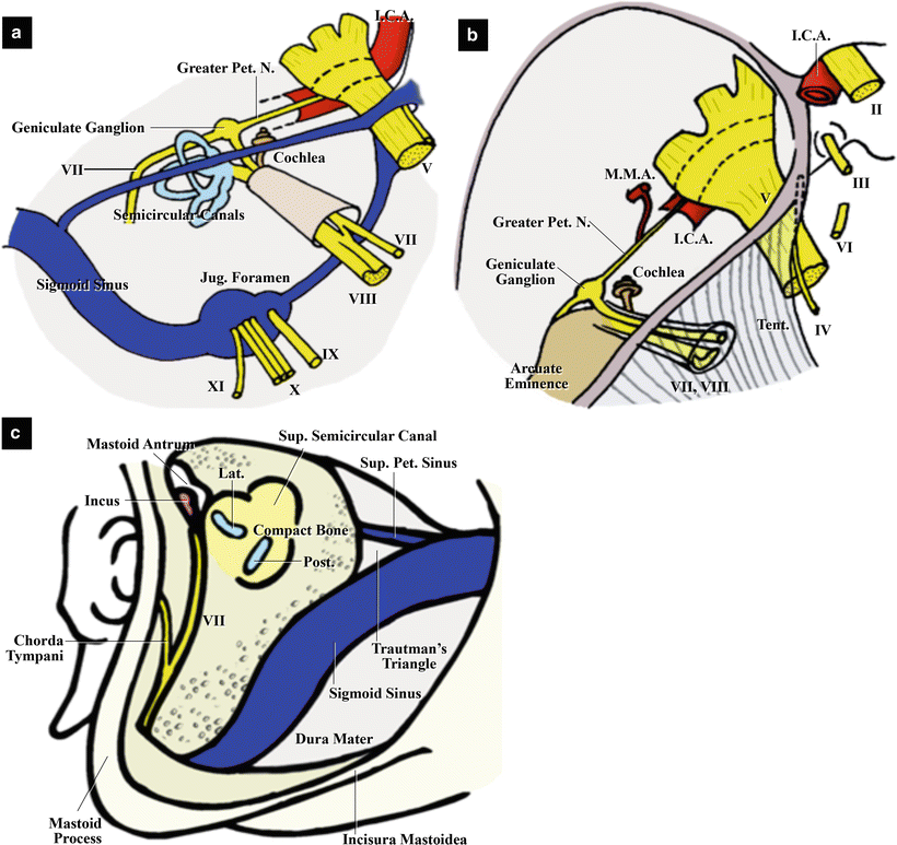 The Temporal Bone: Basic Anatomy and Approaches to Internal Auditory ...
