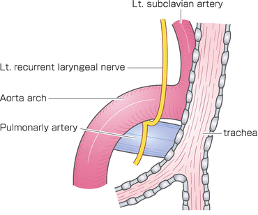 Surgery Transthoracic Esophagectomy | SpringerLink