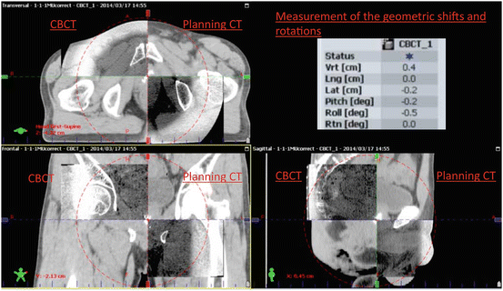 IGRT for IMRT | SpringerLink