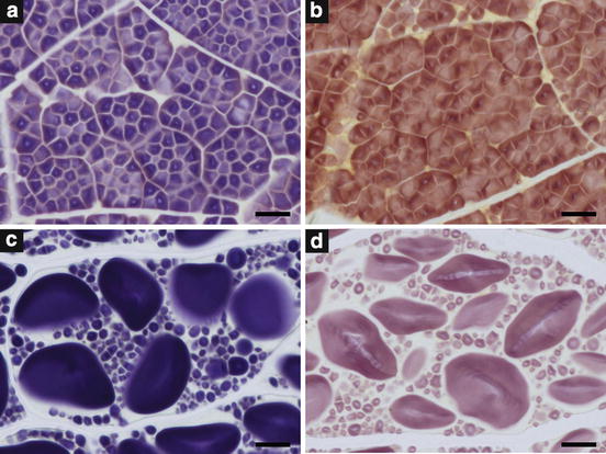 Morphological Variations of Starch Grains | SpringerLink