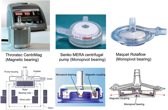 What Kinds of Artificial Hearts Are Available? | SpringerLink