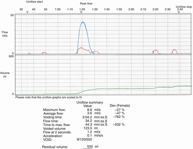 Urodynamics: The Practical Aspects | SpringerLink