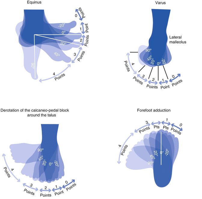 The Inverted Foot | SpringerLink